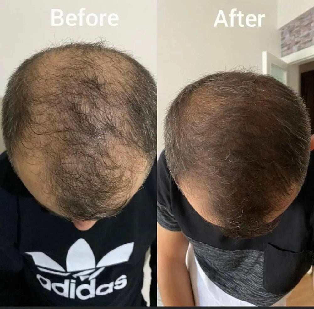 DermaNew Hair growth serum 50 ml – DermaNewHair